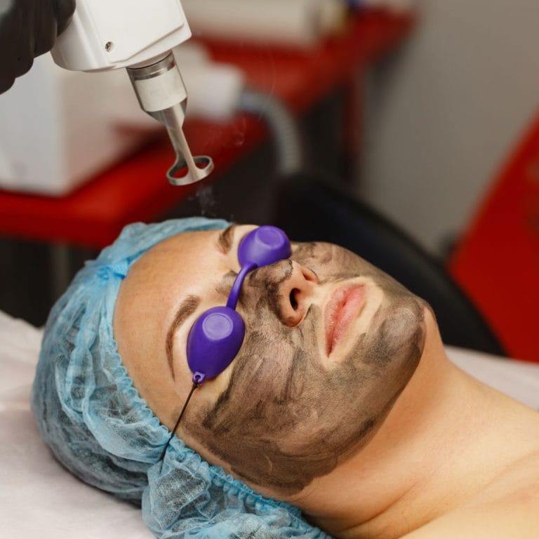 Biaya Laser Wajah (Semua Jenis) Terbaru Tahun 2024 | Klinik Magna